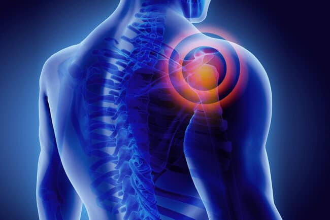 10 Manual Handling Injuries and How to Prevent Them